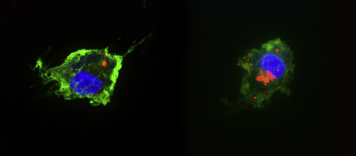 Biomedical Engineering | Northwestern Engineering