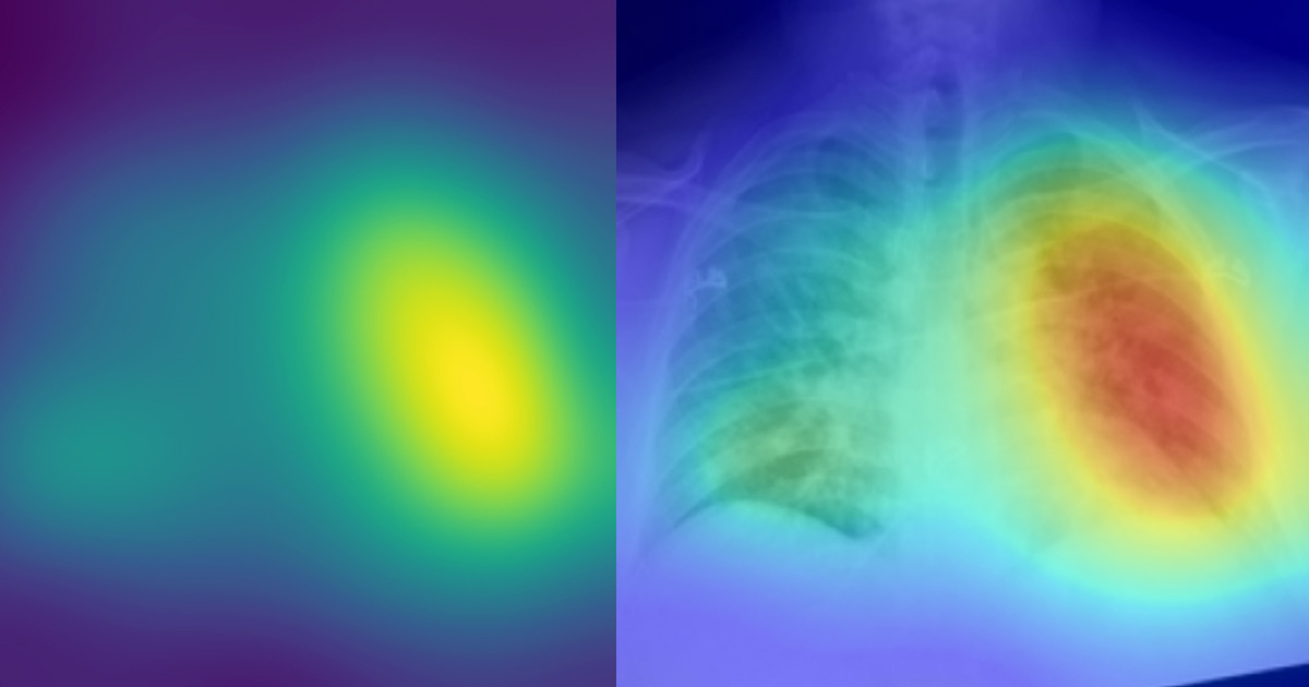 AI Detects COVID-19 on Chest X-rays with Accuracy and Speed | News ...