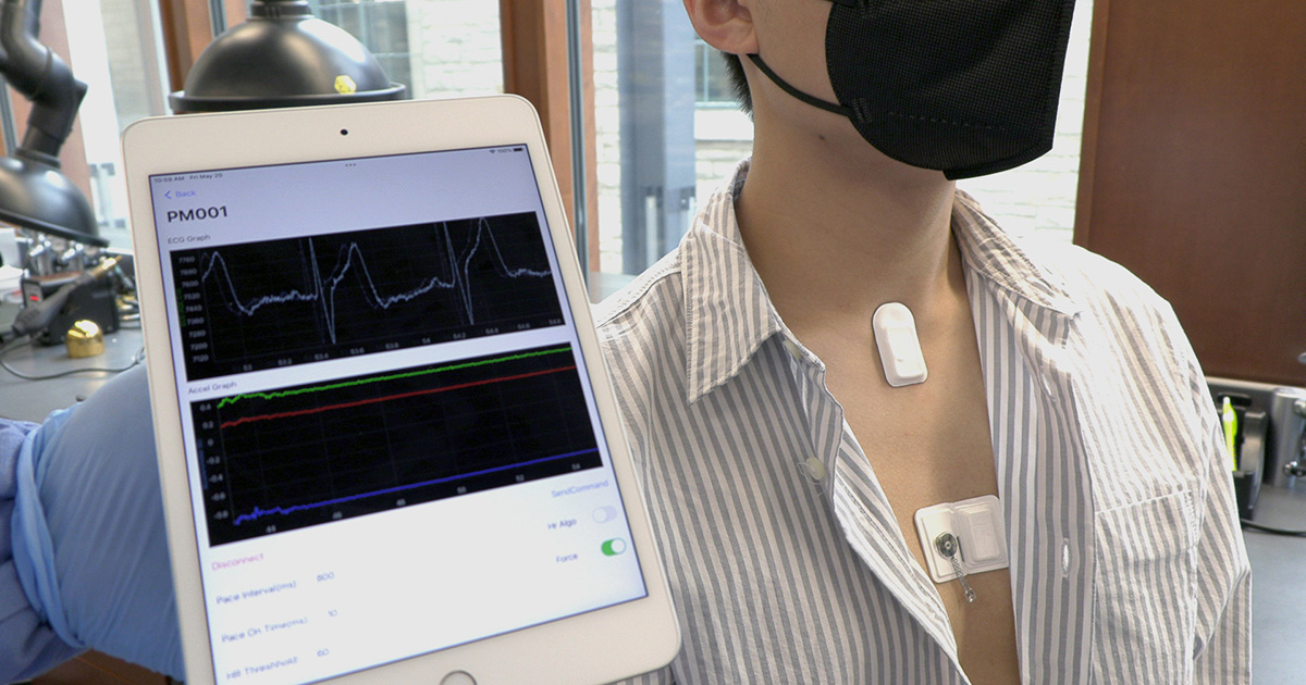 Smart, Dissolving Pacemaker Communicates with Body-area Sensor and ...