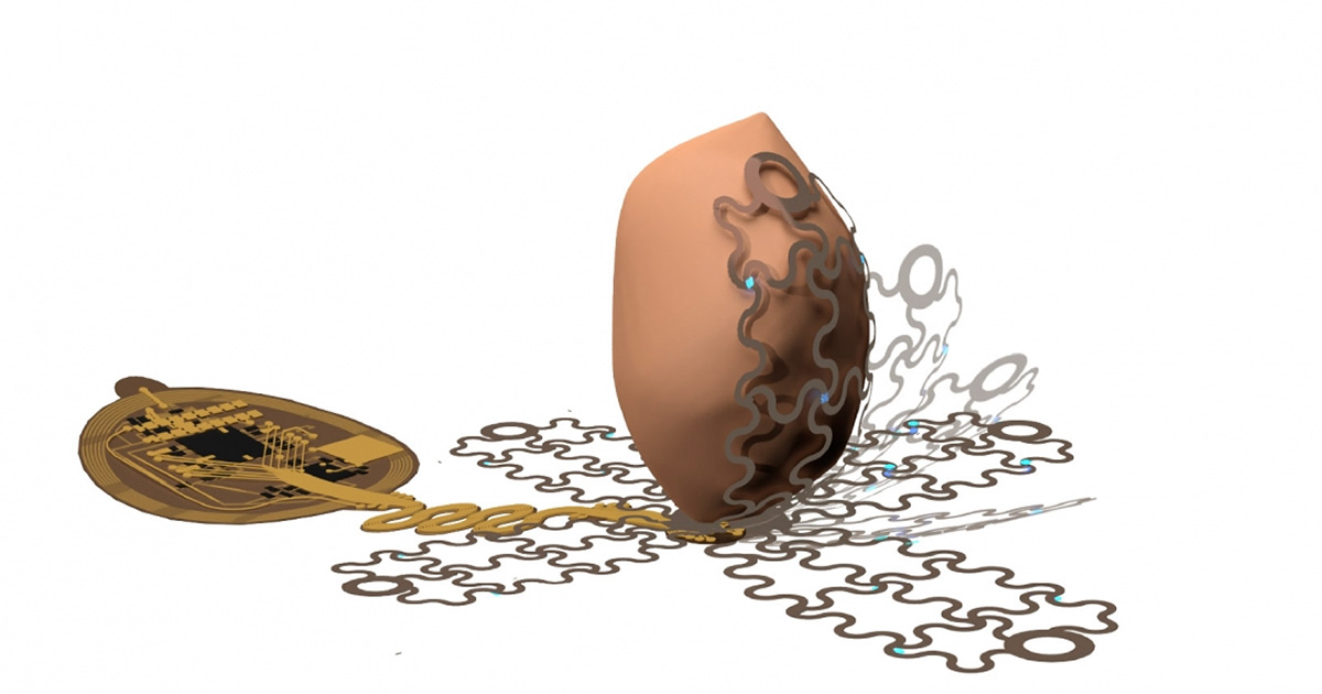 Battery-free, Light-powered Pacemaker may Improve Quality of Life for ...