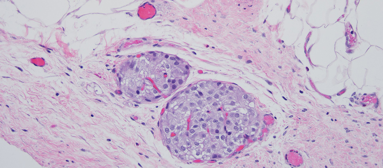 Biomedical Engineering | Northwestern Engineering