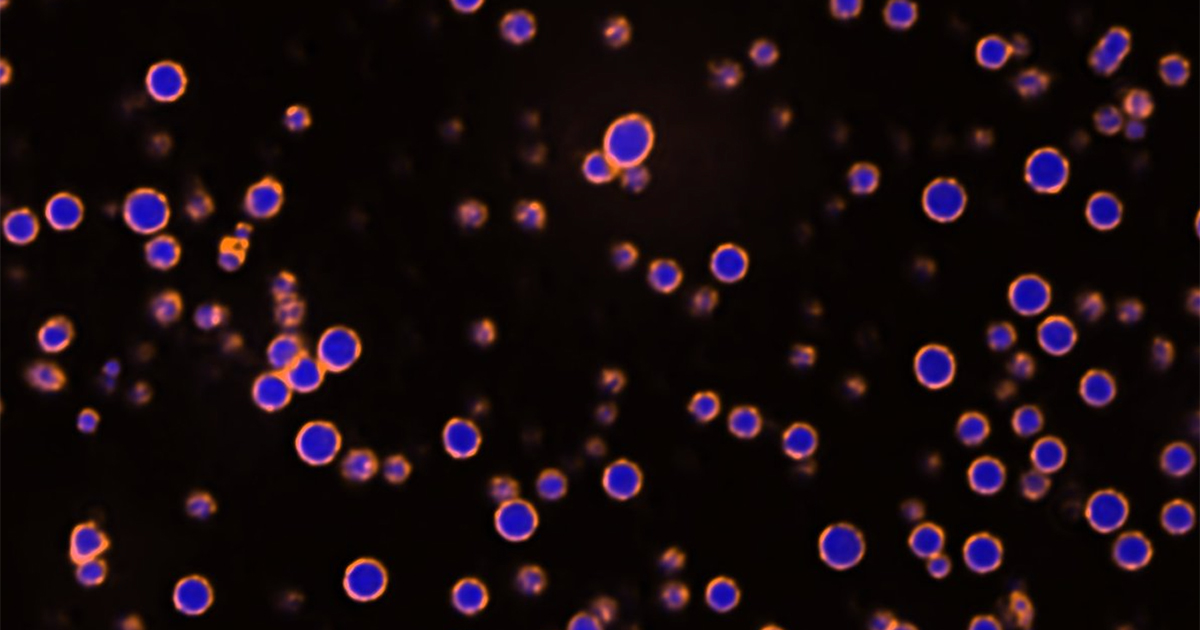 Cell Feature Implicated in Cancer Forms Differently than Previously ...