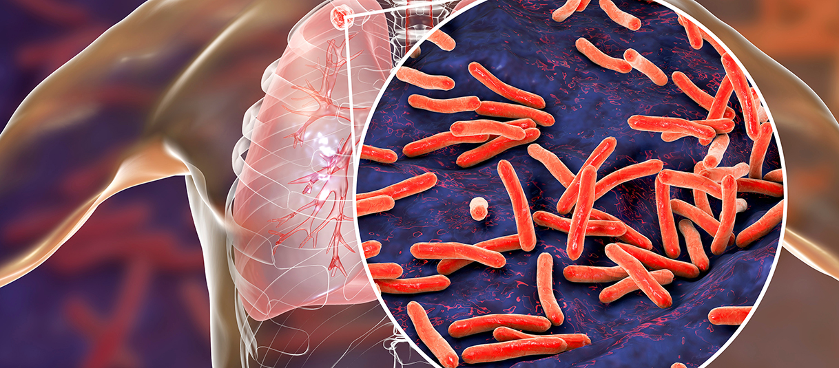 Biomedical Engineering | Northwestern Engineering